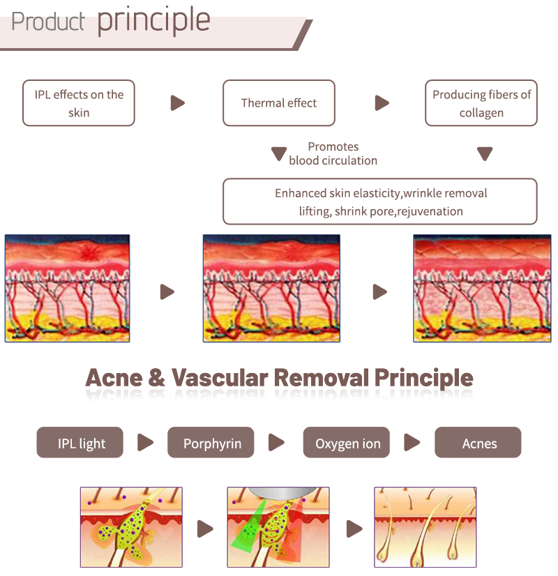 Body Hair Removal Laser Scar Best Ipl Machine Professional from China ...