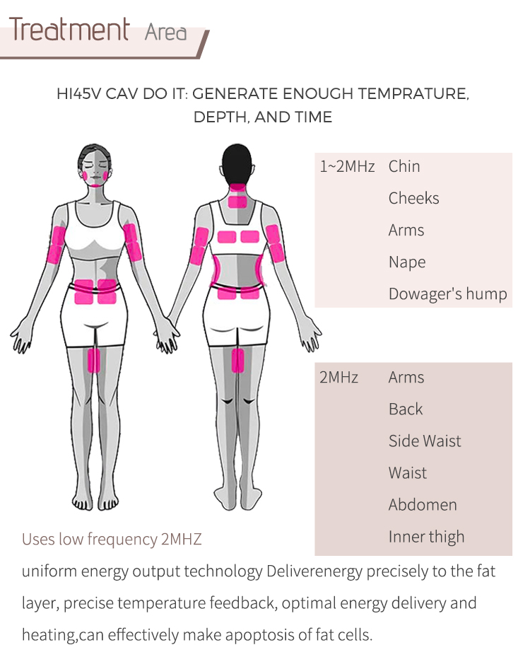 RF All-round Fine Sculpture Machine Tru Sculpting Id Layered Heating ...