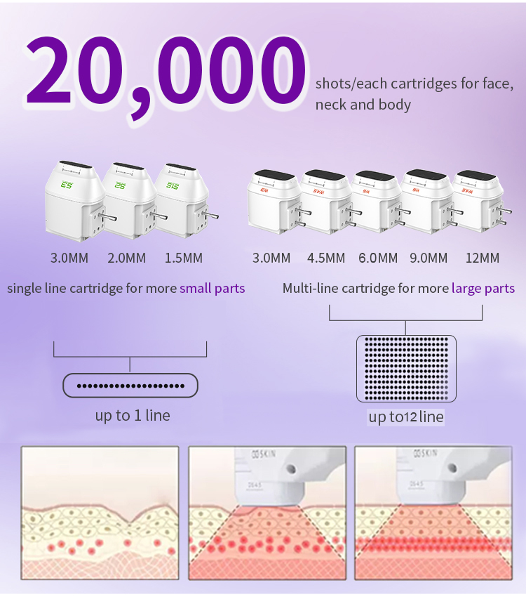 Professional 12D HIFU Machine for Face And Body - Focused Ultrasound ...