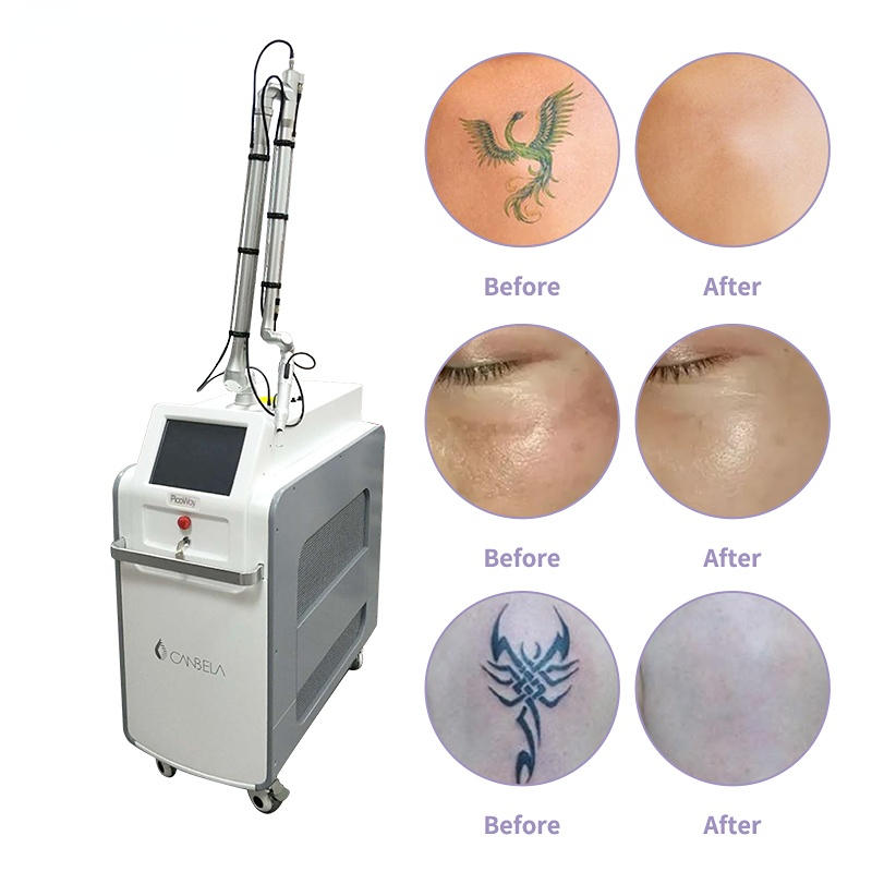 Picoway Laser Tattoo Removal Dark Spots Machine for Sale from China ...